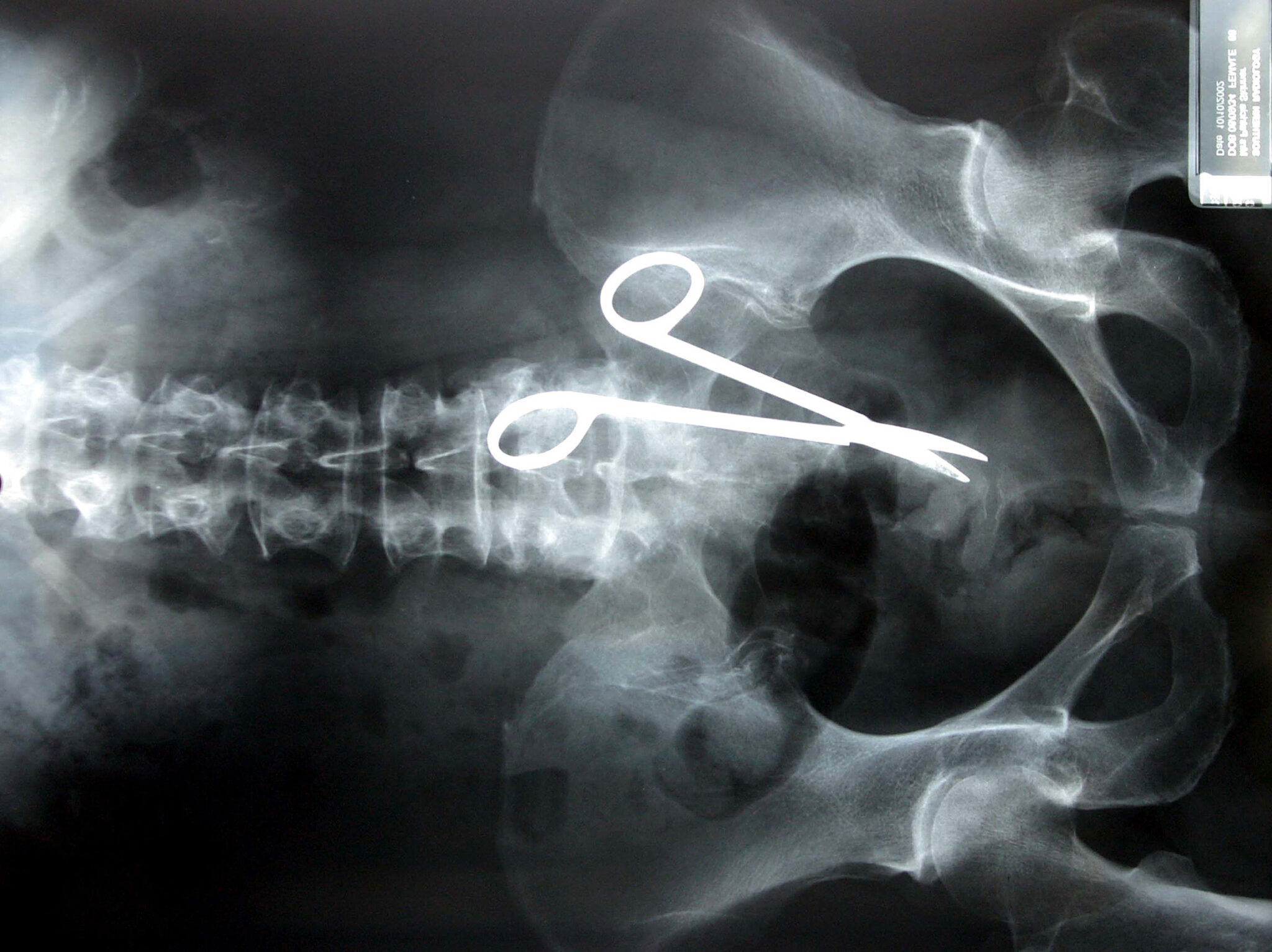 124 jaar röntgenstraling: bizarre röntgenfoto's - KIJK Magazine